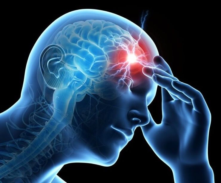 Everything You Need to Know About Concussions | LifeDaily