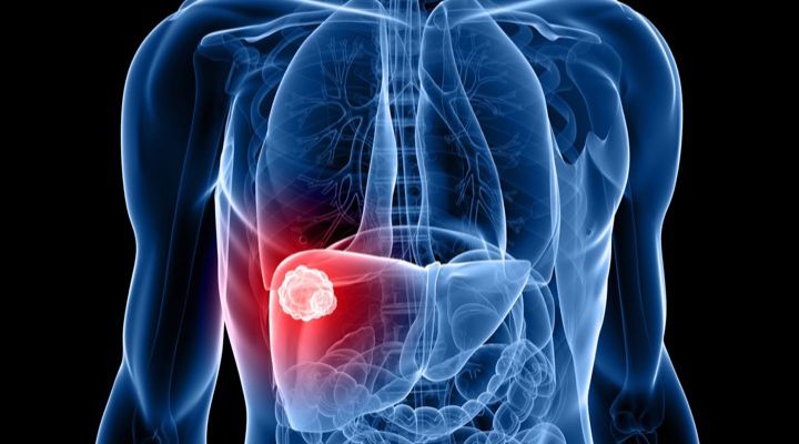 40 Facts About Cancer And Cancer Prevention That Could Save Your Life ...